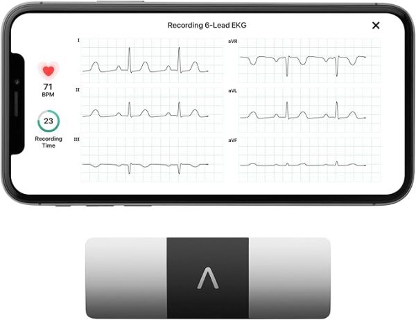 KardiaMobile 6-Lead Personal EKG Monitor – Six Views of The Heart ...