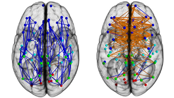 Scientists find genetic basis of brain networks seen in imaging studies ...