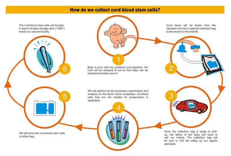 Cord Blood Stem Cell: An Upcoming Life Saver - Women Fitness