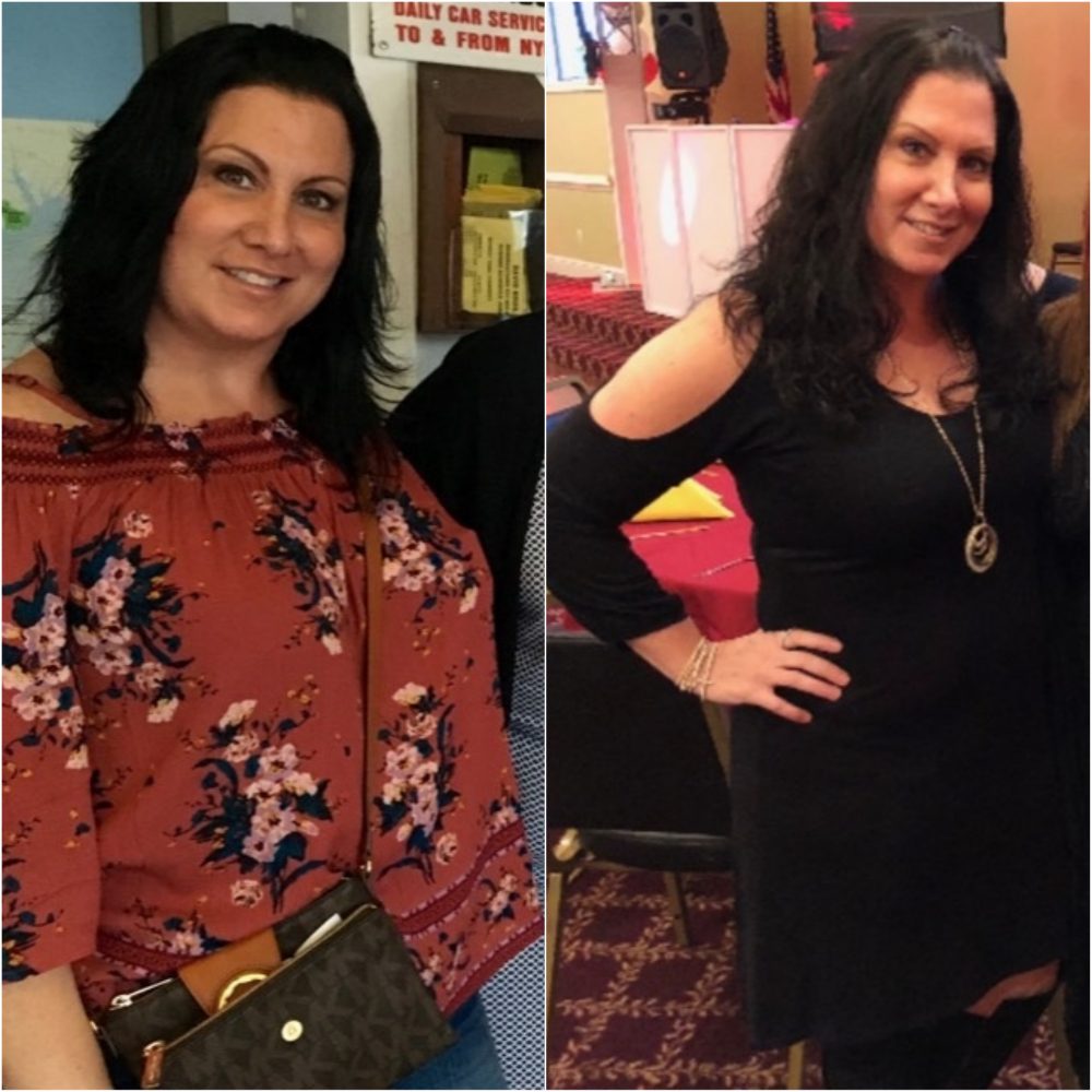 Kristine Immediato Dropped 45 Pounds With The Help Of Dr. David Greuner ...