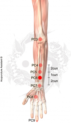 First Aid Measures for a Woman Having Heart Attack at Office - Women ...