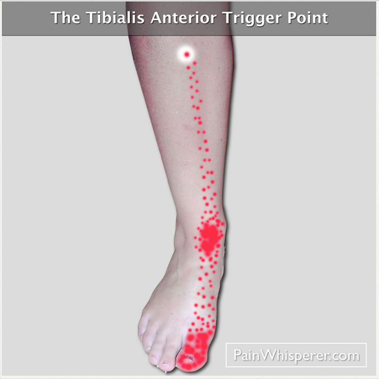 Trigger Point Therapy for Calf, Ankle & Foot Pain – HealthyVox
