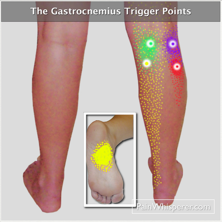 Trigger Point Therapy for Calf, Ankle & Foot Pain – HealthyVox