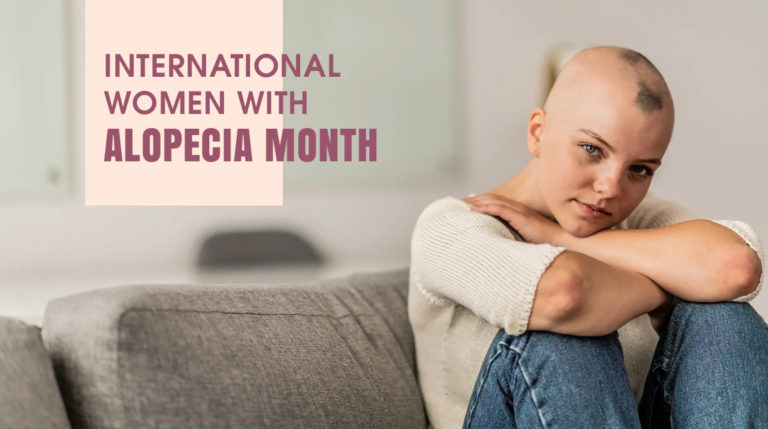 Alopecia Awareness Month - Women Fitness