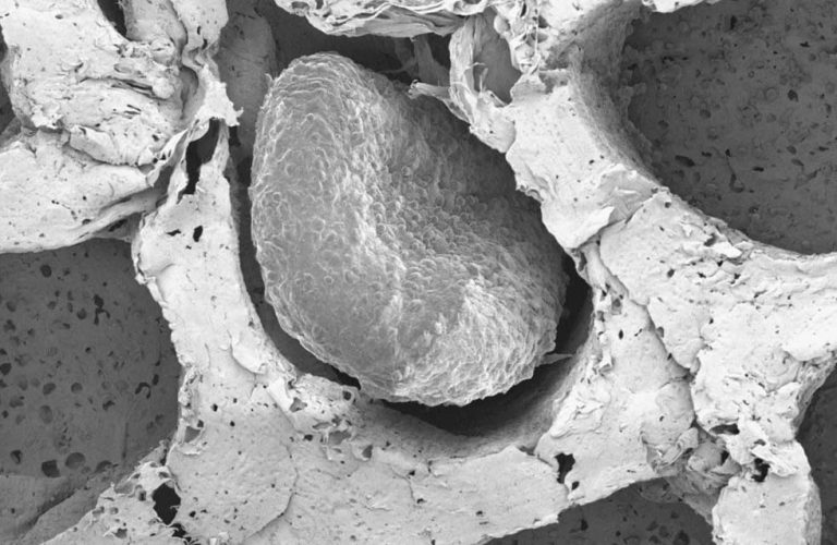 How Hungry Fat Cells could Someday Starve Cancer to Death - Women Fitness