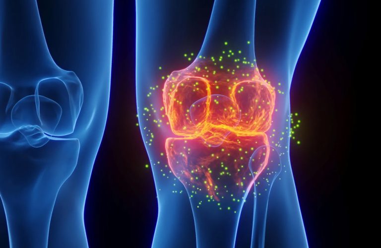 Stanford Scientists Found a Way to Regrow Cartilage and Stop Arthritis ...